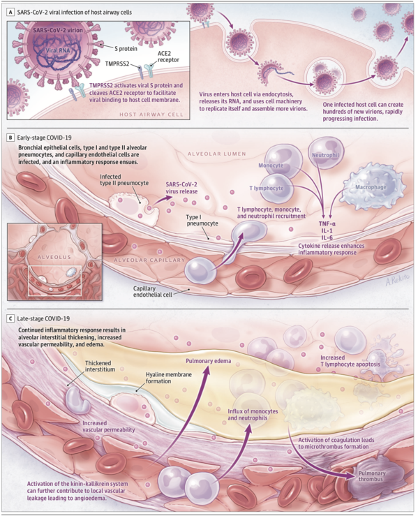 Pathophysiology, Transmission, Diagnosis, and Treatment of Coronavirus ...